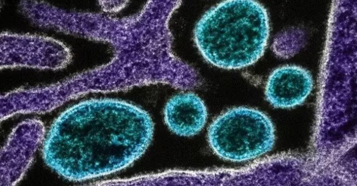 Nipah Strikes Kerala: 5 Infected, 700 Contacts Traced, 77 High-Risk ...